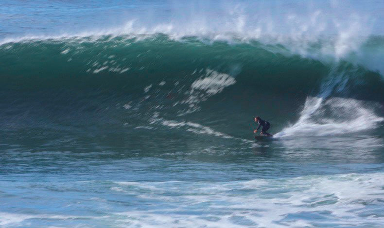 Surfer’s Eye (Pterygium) Symptoms, Treatment & Prevention